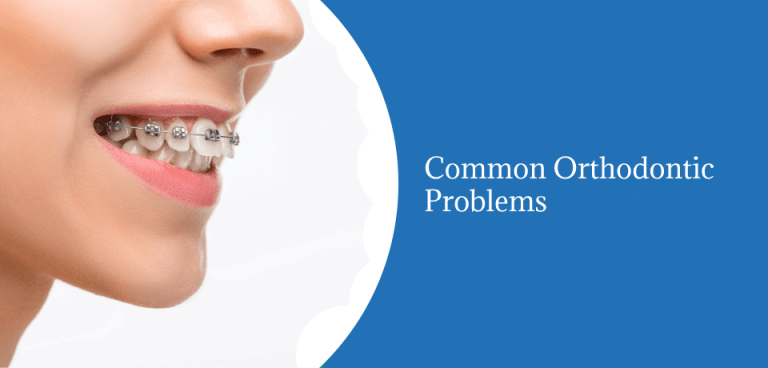 Common Orthodontic Problems | Crossroads Deira