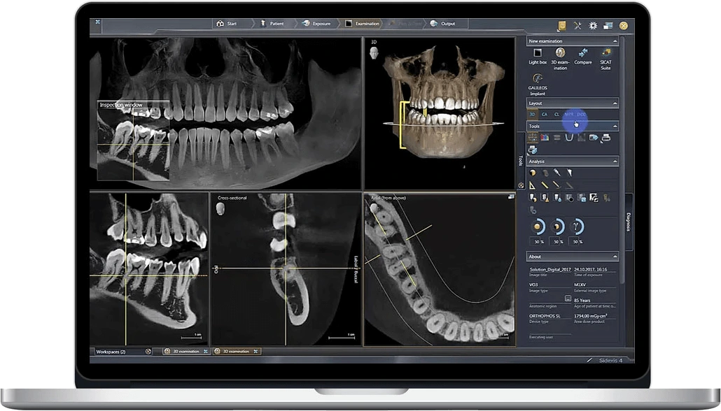 Affordable 3D CBCT & OPG Scan in Dubai | Crossroads Dentals